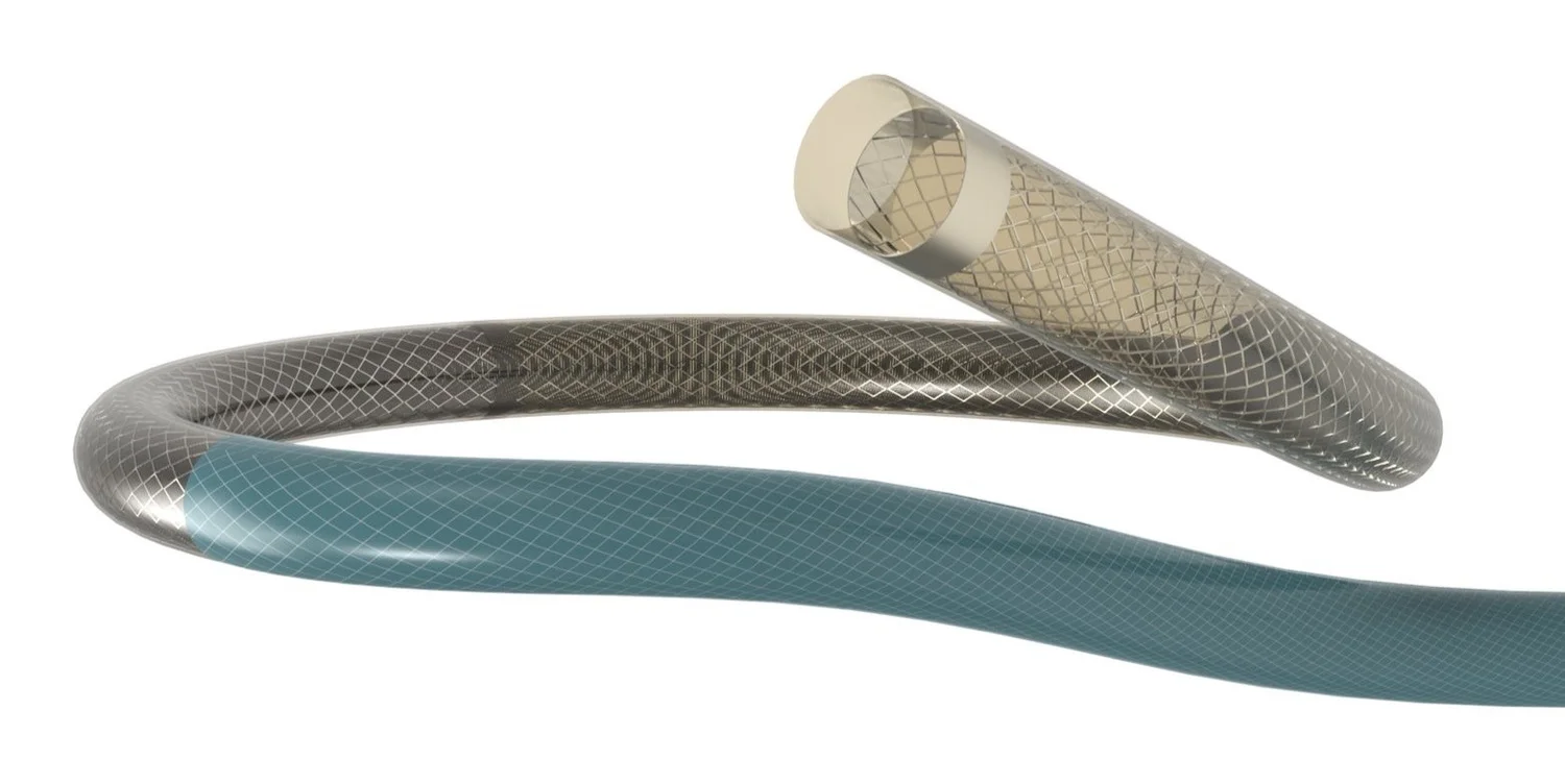 Neurovascular | Nventric | Medical Devices