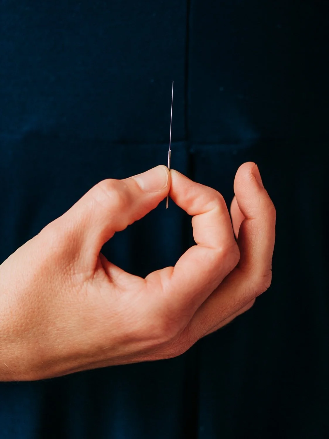 The Magic within Acupuncture — Wild Blossom Acupuncture