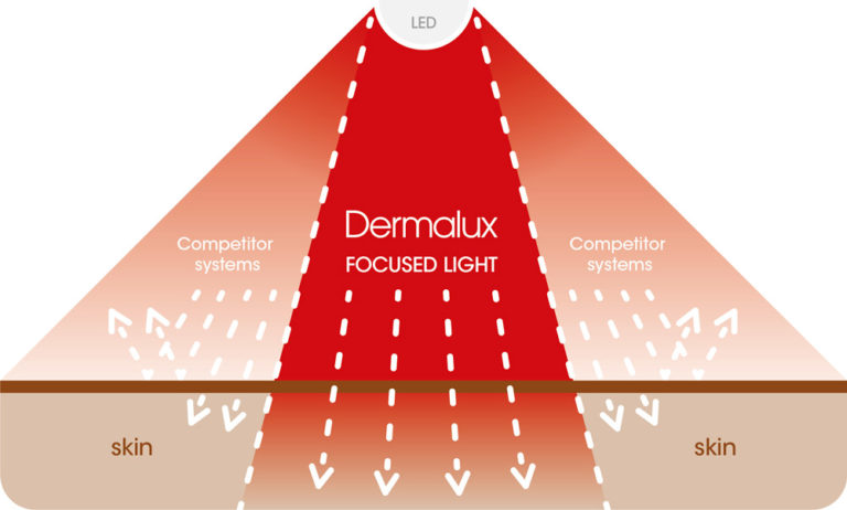 Our Technology — Dermalux LED Australia