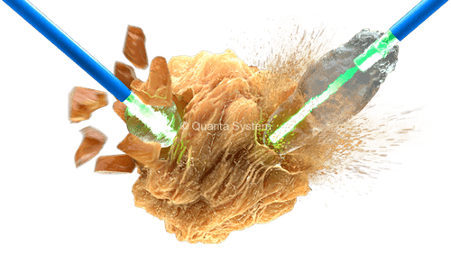 MEDILAZE | QUANTA SYSTEMS | CYBER HO MAGNETO 150W