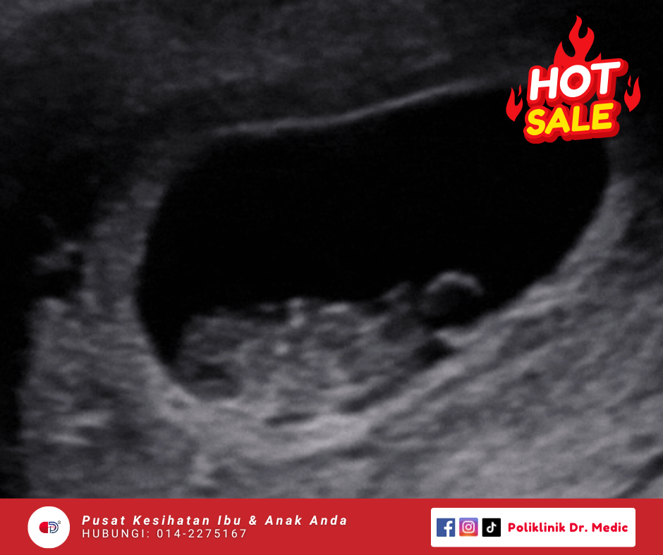 Scan Bayi Lengkap & Selamat | Pemeriksaan Kehamilan Profesional ...