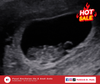 Scan Bayi Lengkap & Selamat | Pemeriksaan Kehamilan Profesional ...