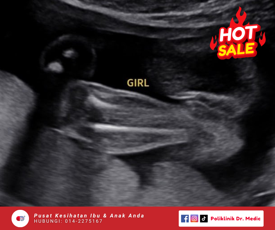 Scan Bayi Lengkap & Selamat | Pemeriksaan Kehamilan Profesional ...