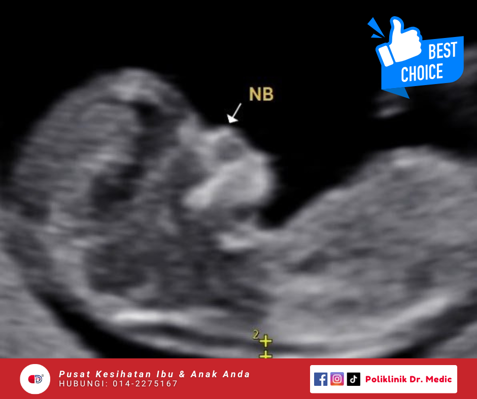 Scan Bayi Lengkap & Selamat | Pemeriksaan Kehamilan Profesional ...