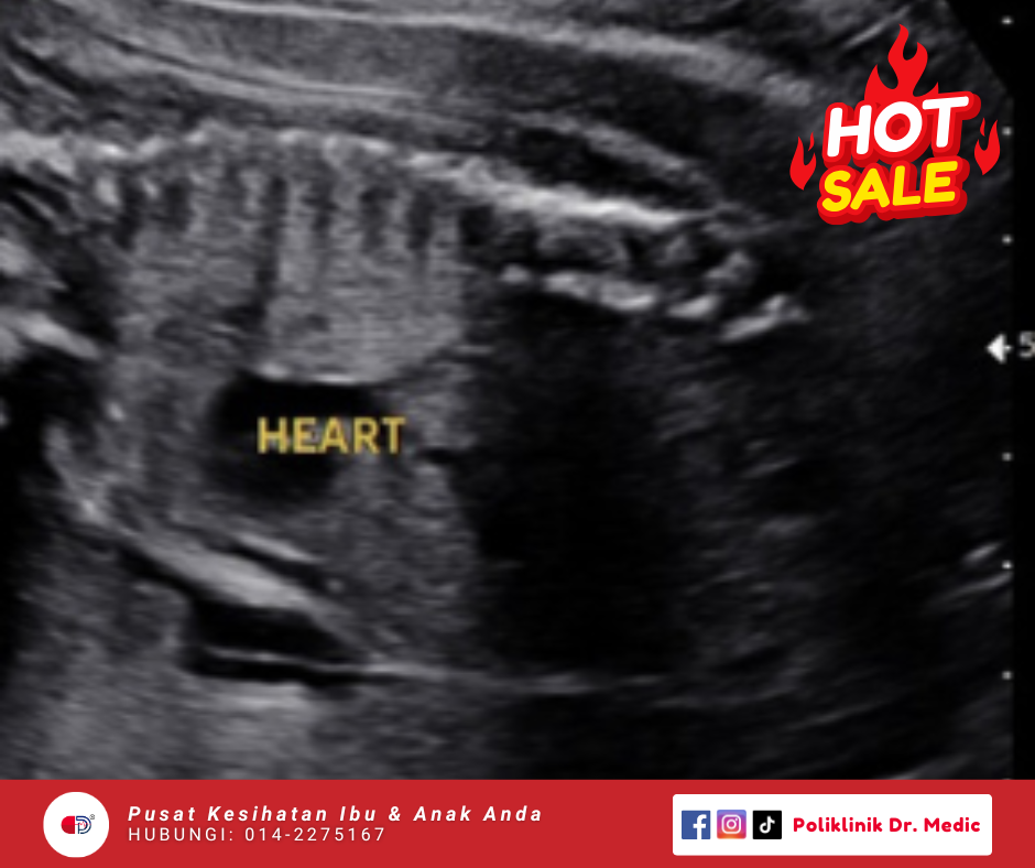 Scan Bayi Lengkap & Selamat | Pemeriksaan Kehamilan Profesional ...