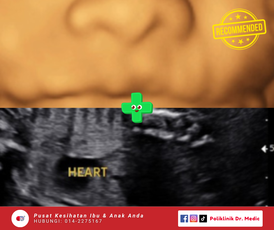 Scan Bayi Lengkap & Selamat | Pemeriksaan Kehamilan Profesional ...