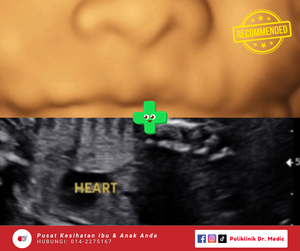 Scan Bayi Lengkap & Selamat | Pemeriksaan Kehamilan Profesional ...