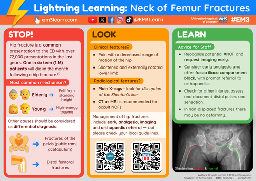 Neck of Femur Fractures — EM3