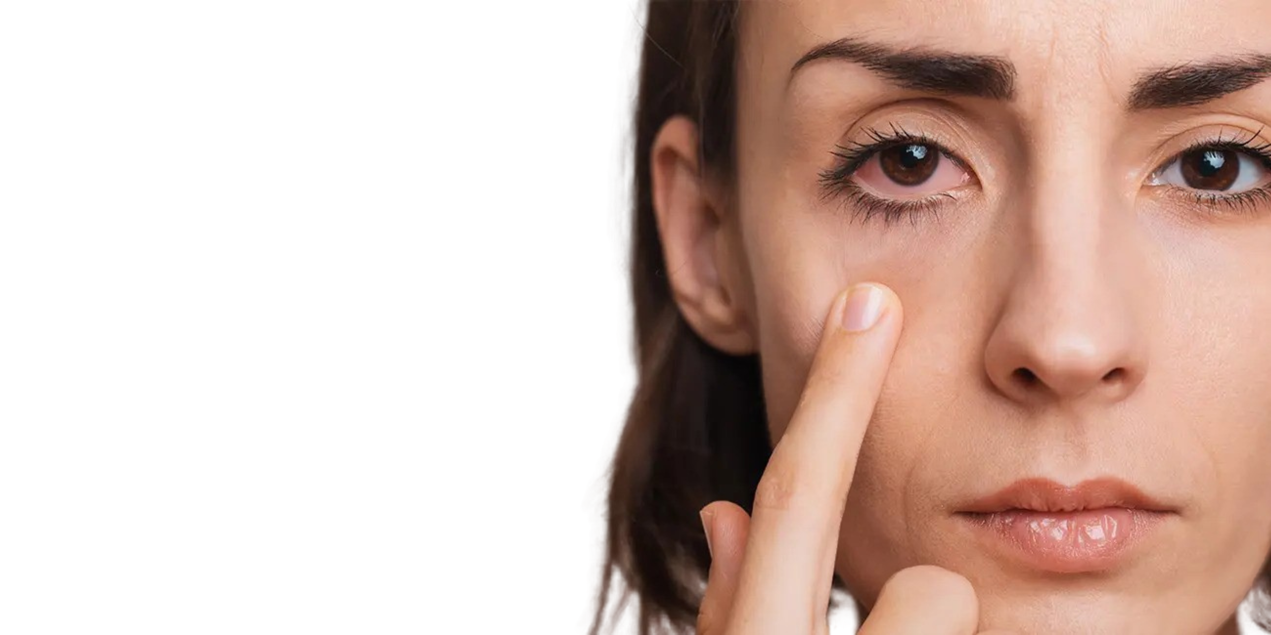 Dry Eye Treatments — Eyes @ Optometry | Expert Eye Care