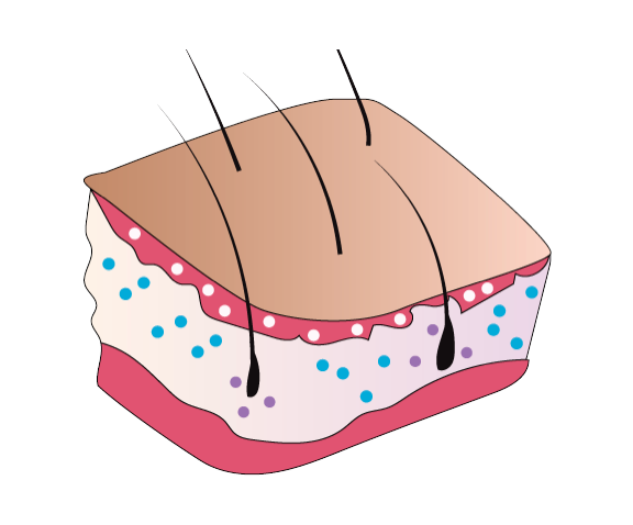 PolarityBio - Advancing Regenerative Skin Therapy for Chronic Wounds