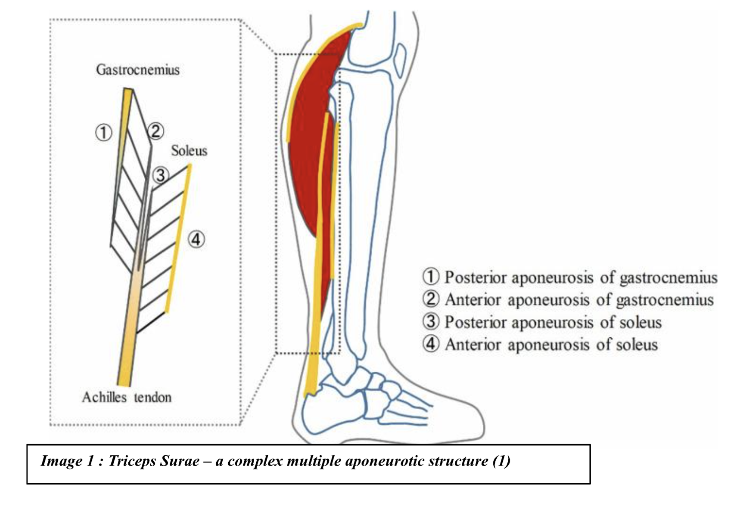 Lower Limb Aponeurotic Injuries — NBPTA