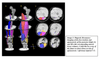 Lower Limb Aponeurotic Injuries — NBPTA