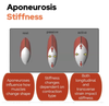 Lower Limb Aponeurotic Injuries — NBPTA