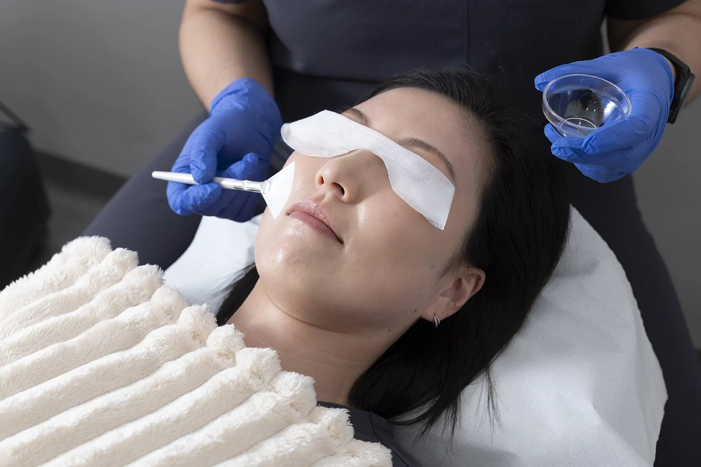 Chemical Peels Graceville | Brisbane | Book your consult Now | Shades ...