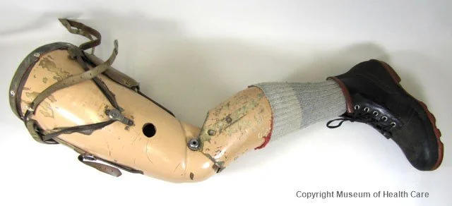 Getting a Leg Up: A Brief History of Prosthetics through the lens of ...