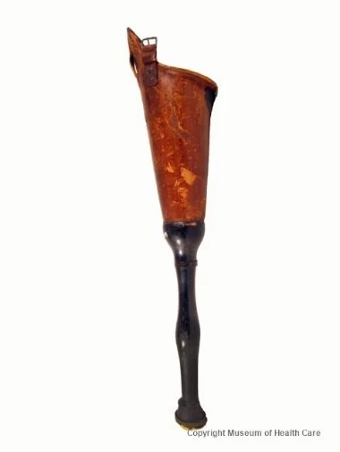 Getting a Leg Up: A Brief History of Prosthetics through the lens of ...