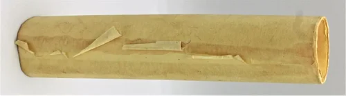 The Story of Dr. René Laennec and His Stethoscope — Canadian Museum of ...