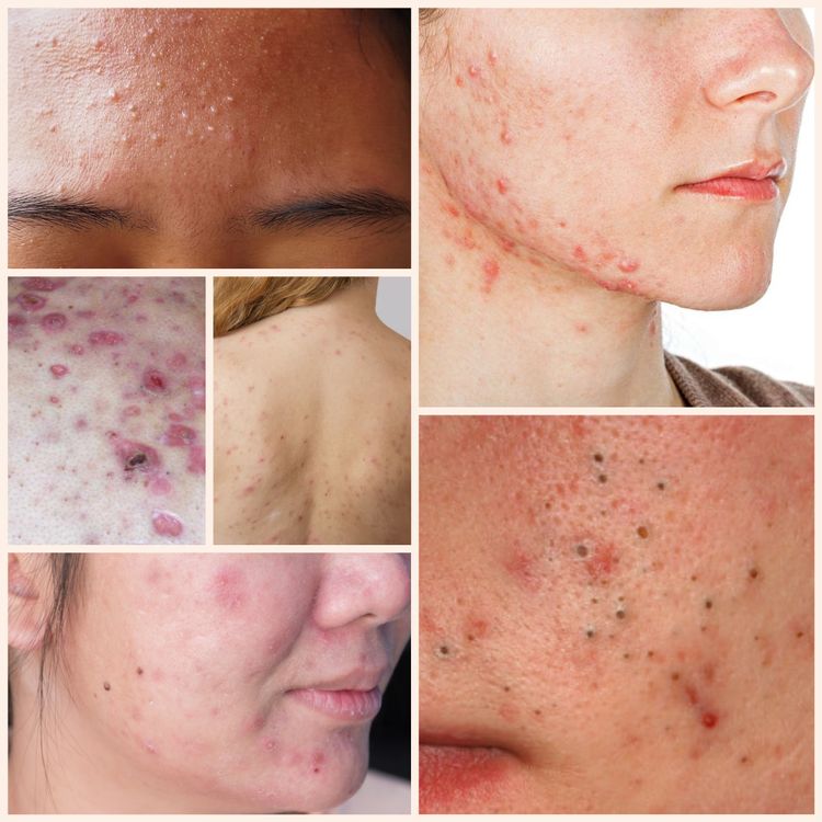 Comprehensive Dermatology Services in Dallas | Treating Skin & Hair ...