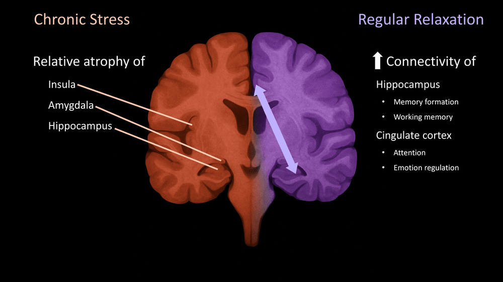 What Happens in Your Brain During Deep Relaxation? — MelodiaSync