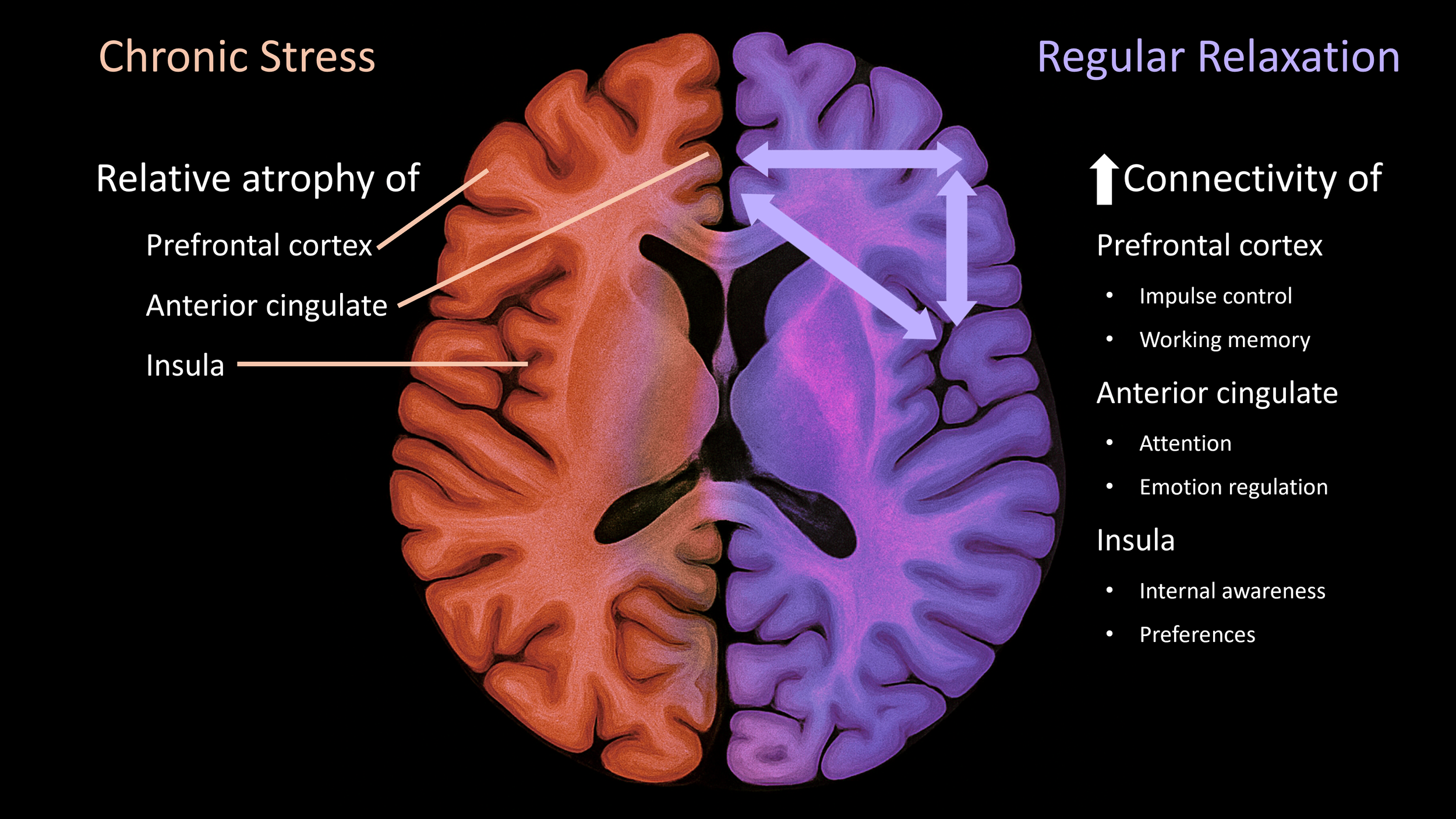 What Happens in Your Brain During Deep Relaxation? — MelodiaSync