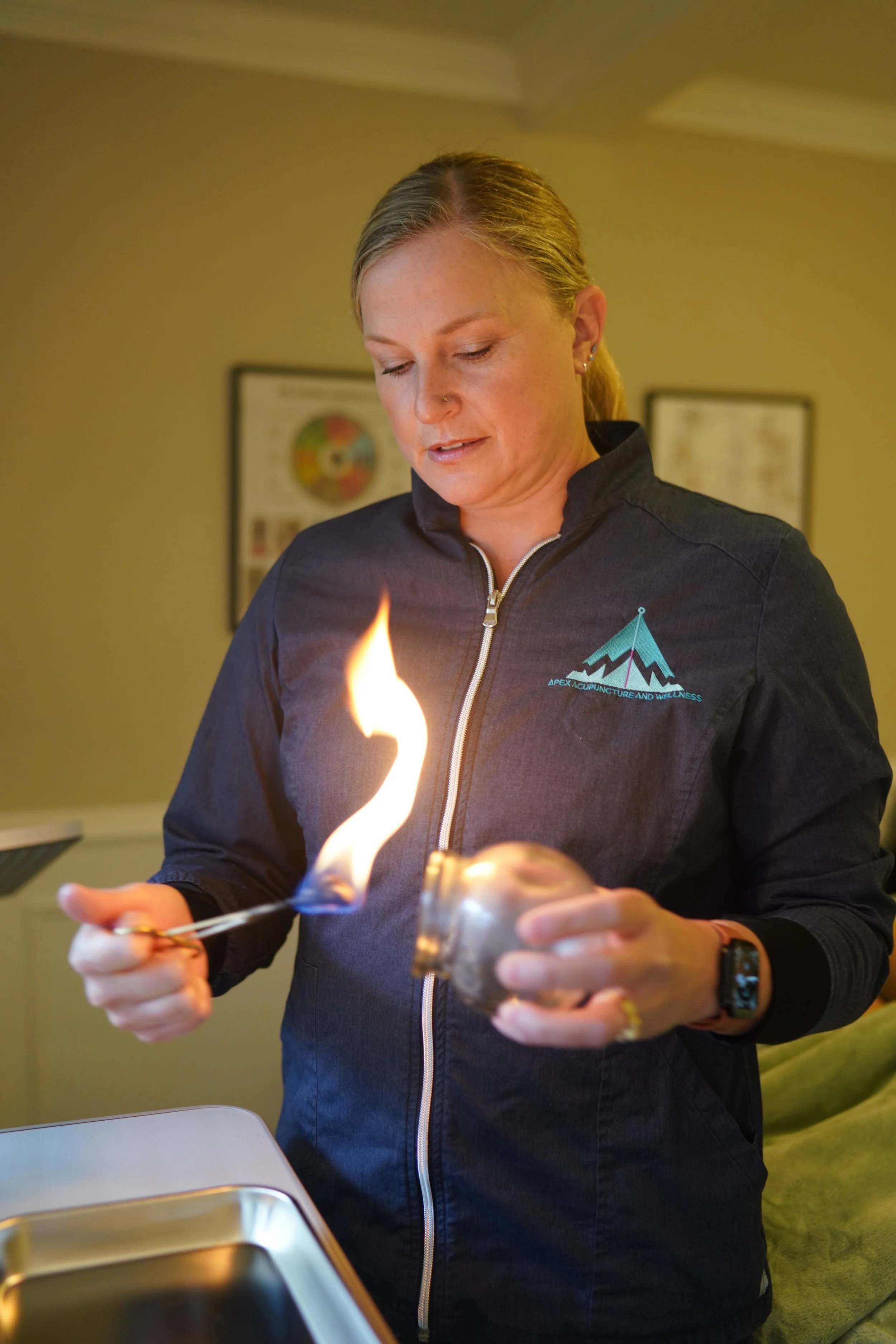 Acupuncture in Bellevue, WA | Apex Acupuncture & Wellness