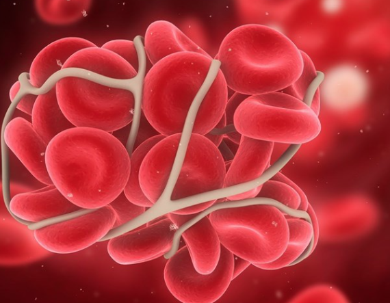 Can Red Light Therapy Help with Blood Clots? — Medford Red Light Therapy