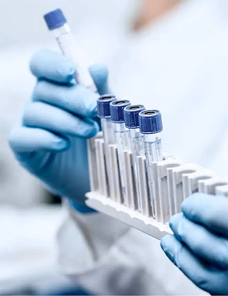 Lab24 | Local Lab Testing in Redding, CA