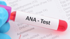 Understanding a Positive ANA Test: What It Really Means | Dr. Michelle ...