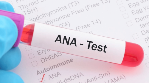 Understanding a Positive ANA Test: What It Really Means | Dr. Michelle ...