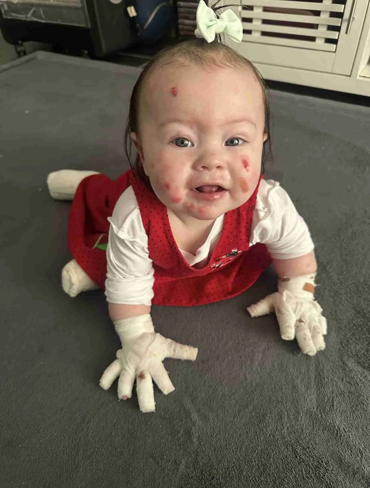 EB Research Partnership Australia | Help Cure EB