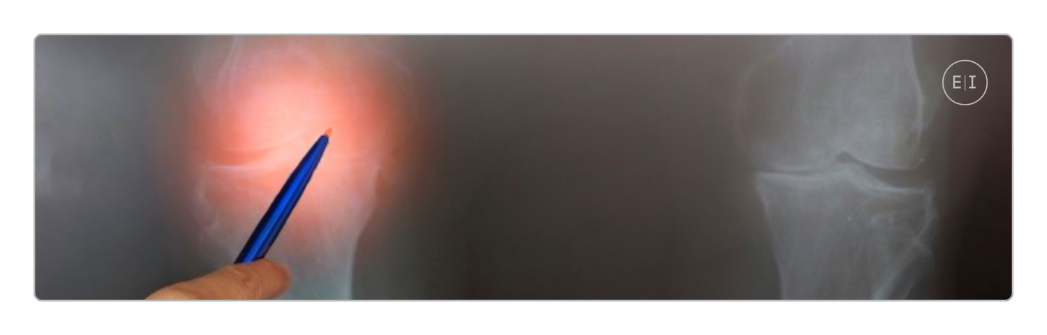 Peeking Inside Your Joints: Understanding the Arthrogram — Evolution ...