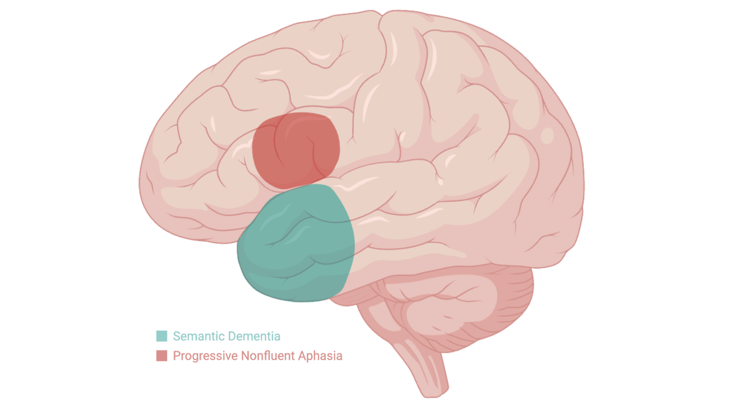 Language Subtypes — FRONTIER FTD Research Group
