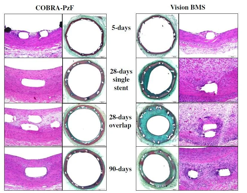 PolyZene-F Coating | Biocompatible Medical Coating — Alta Biomed