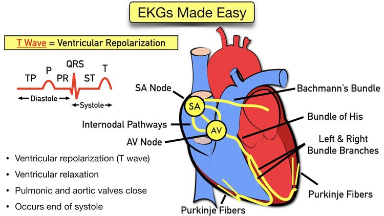 ECG Waveform Explained: EKG Labeled Diagrams and Components — Simplico