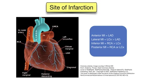 ICD-10-CM Medical Code Lookup: Ischemic Heart Disease, Heart Attack ...