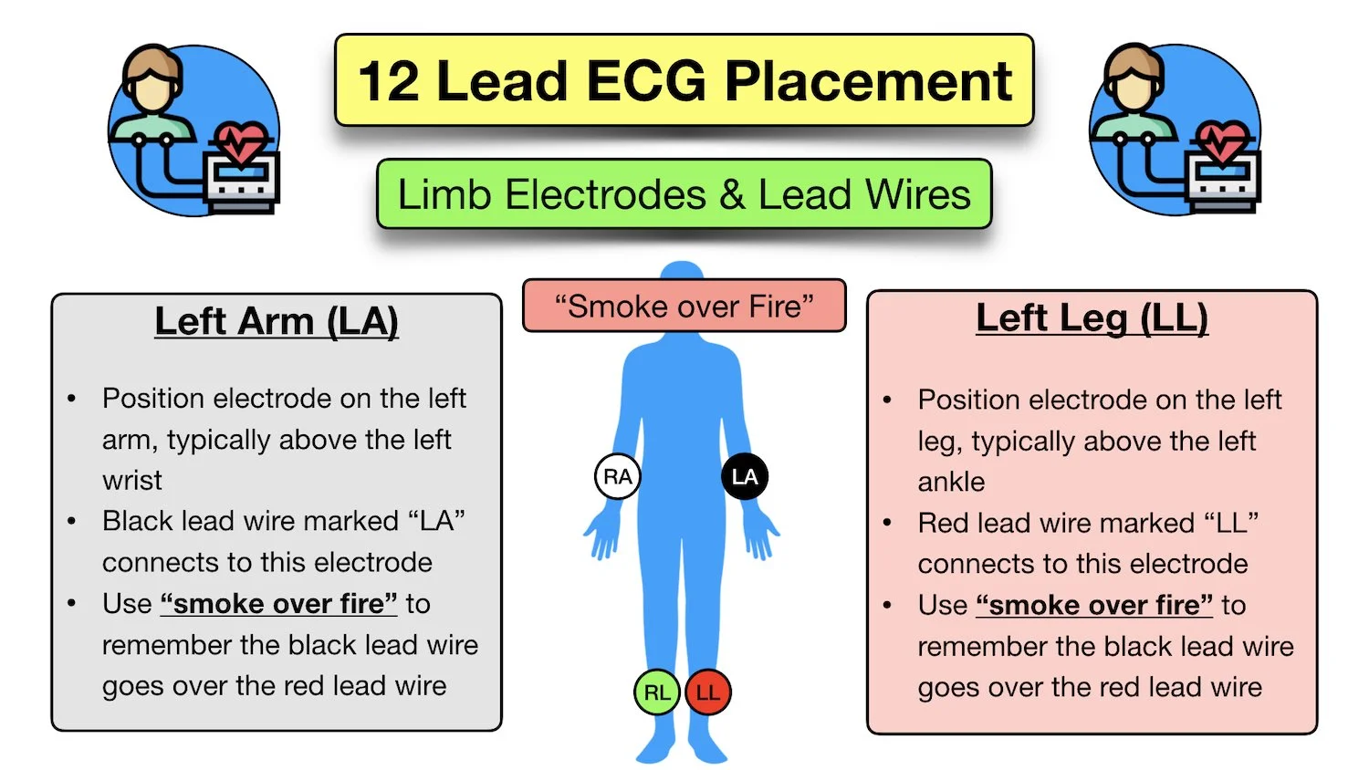 12 Lead ECG Placement: Diagram and Mnemonic for Limb and Precordial ...