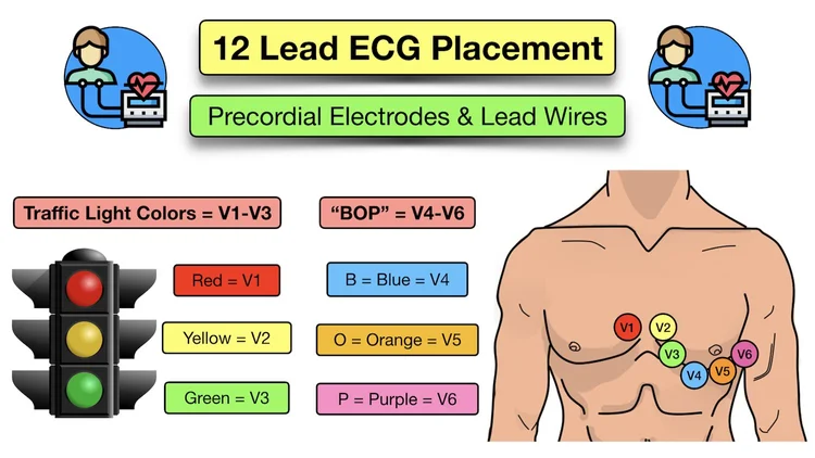12 Lead ECG Placement: Diagram and Mnemonic for Limb and Precordial ...