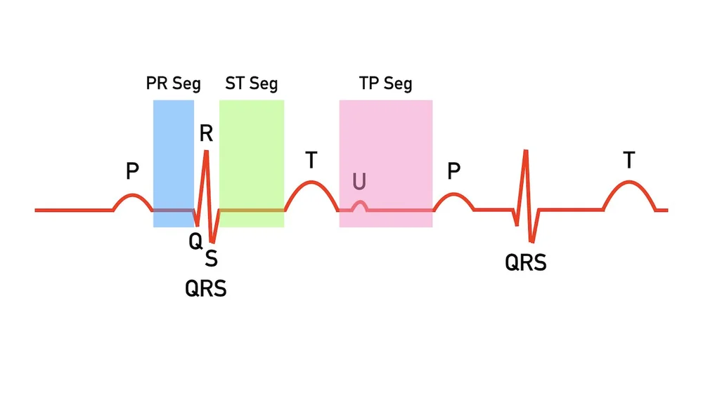 ECG Waveform Explained: EKG Labeled Diagrams and Components — Simplico
