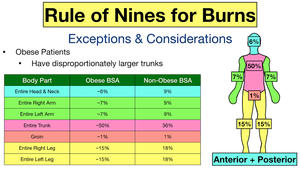 Rule of Nines for Burns: Child and Adult Chart, Calculator, Definition ...