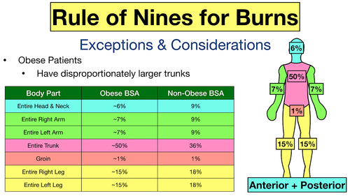 Rule of Nines for Burns: Child and Adult Chart, Calculator, Definition ...