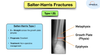 Salter-Harris Fracture Types | Classification System Mnemonic ...