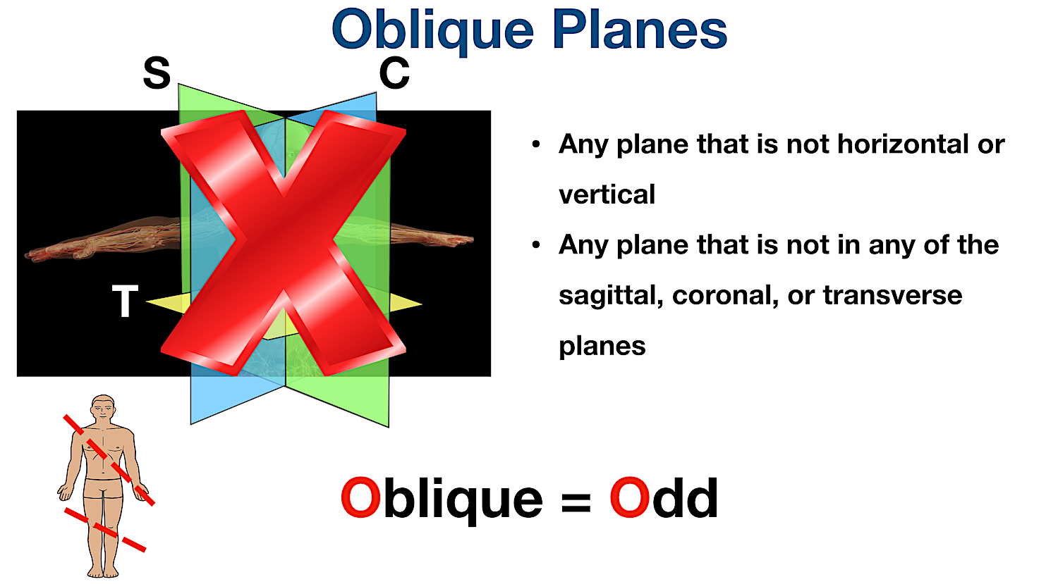 Body Planes and Sections: Anatomical Position, Directional Term ...
