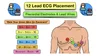 12 Lead ECG Placement: Diagram and Mnemonic for Limb and Precordial ...