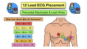 12 Lead ECG Placement: Diagram and Mnemonic for Limb and Precordial ...