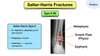Salter-Harris Fracture Types | Classification System Mnemonic ...