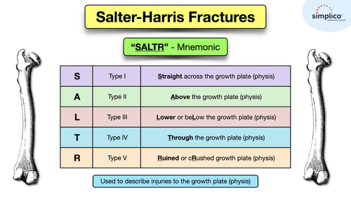 Salter-Harris Fracture Types | Classification System Mnemonic ...