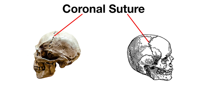 Body Planes and Sections: Anatomical Position, Directional Term ...