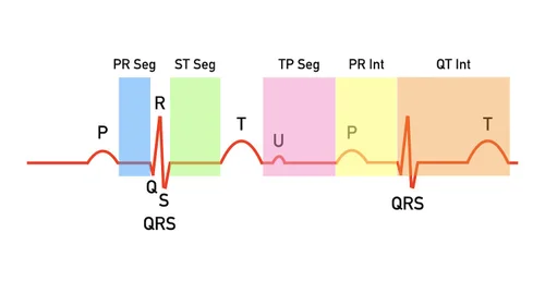 ECG Waveform Explained: EKG Labeled Diagrams and Components — Simplico