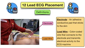 12 Lead ECG Placement: Diagram and Mnemonic for Limb and Precordial ...