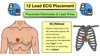 12 Lead ECG Placement: Diagram and Mnemonic for Limb and Precordial ...